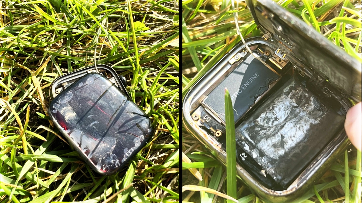 Apple Watch Explodes And Sends Man To Hospital